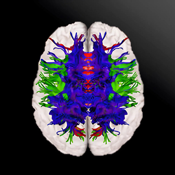 MRI | Premier Medical Imaging - MRI | Premier Medical Imaging Centers ...